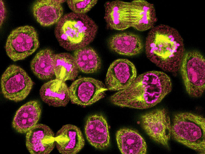 'Immortal' Cells Of Henrietta Lacks Live On In Labs : NPR