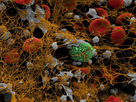 Blood: It's A Jungle In There : Shots - Health News : NPR