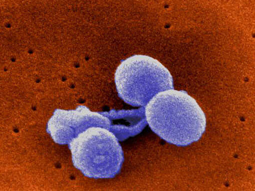 Lurking Bacteria Raise Risks From Swine Flu : Shots - Health News : NPR