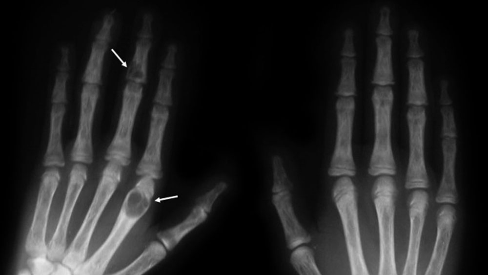 NIH Pushes For Radiation Reporting By Scanner Makers : Shots - Health ...