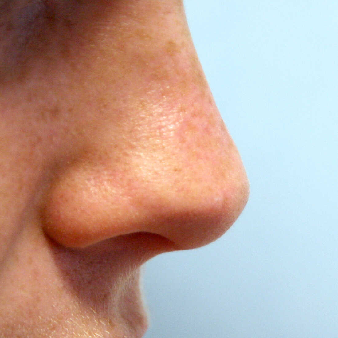 Communication Technology For Disabled Is Nothing To Sniff At : Shots ...