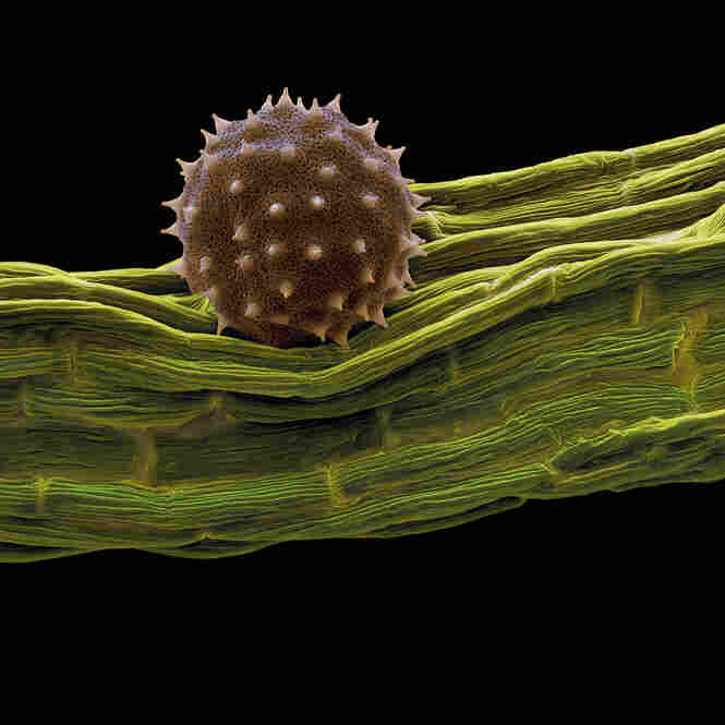 Tree Pollen Under A Microscope