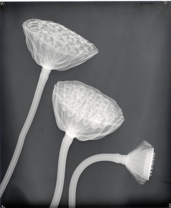 A Camera That Can See Straight Through You : The Picture Show : NPR