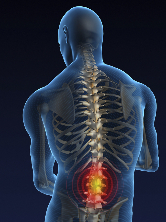 Common Diagnostic Test May Prolong Low Back Pain : Shots - Health News ...
