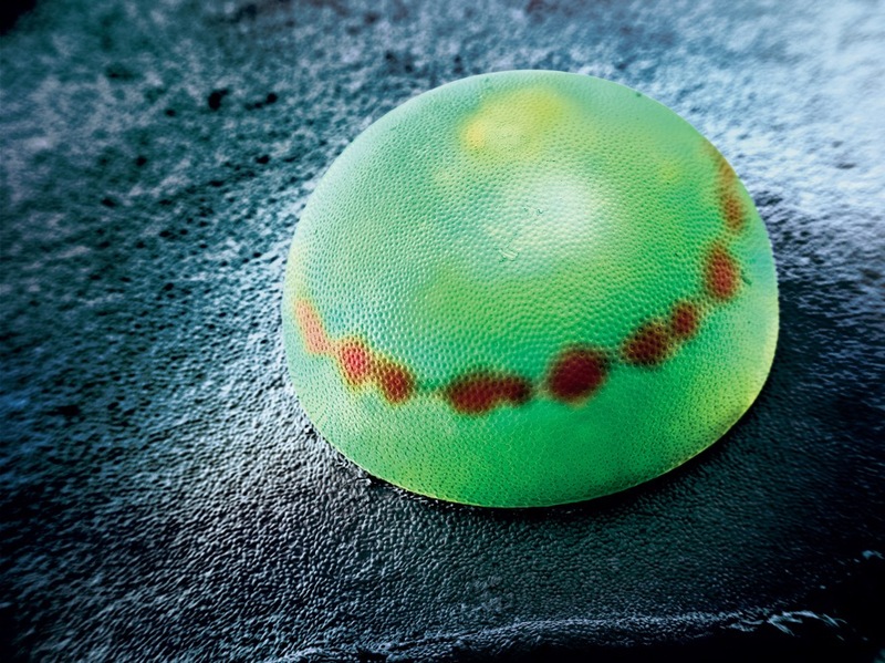 The Beauty Of Bug Eggs : The Picture Show : NPR