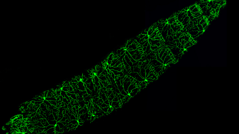 Eyeless Larvae 'See' With Full Body Nerve Cells : NPR