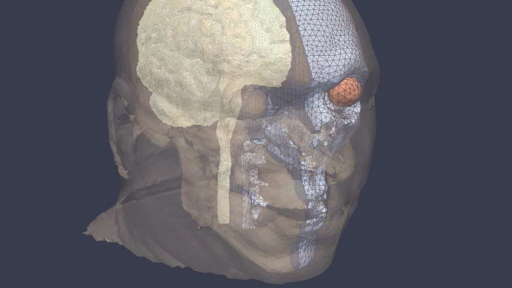 Helmet Face Shields Could Prevent Military Brain Injuries : Shots ...