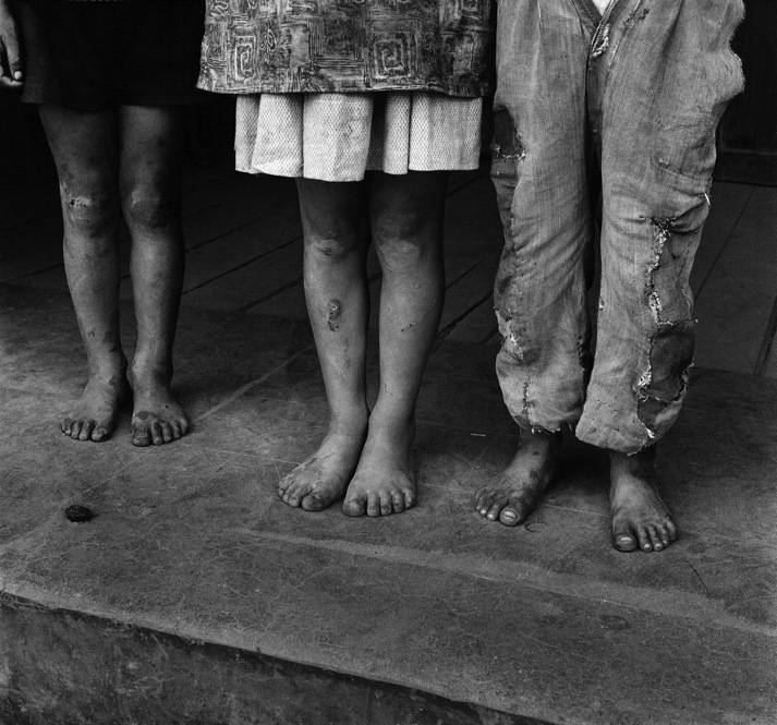 Milton Rogovin, Photographer Of 'Forgotten Ones,' Dies At 101 : The ...