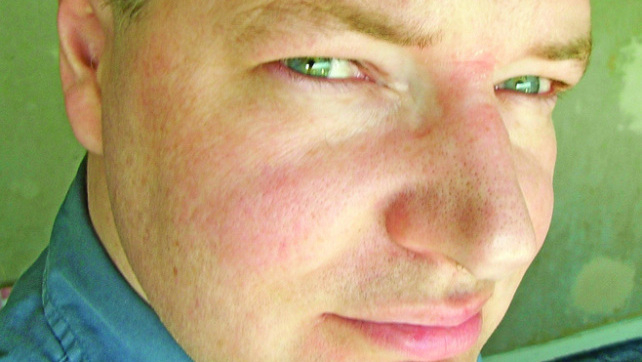 Telling 'Psychiatric Tales' To Destigmatize Disease : NPR