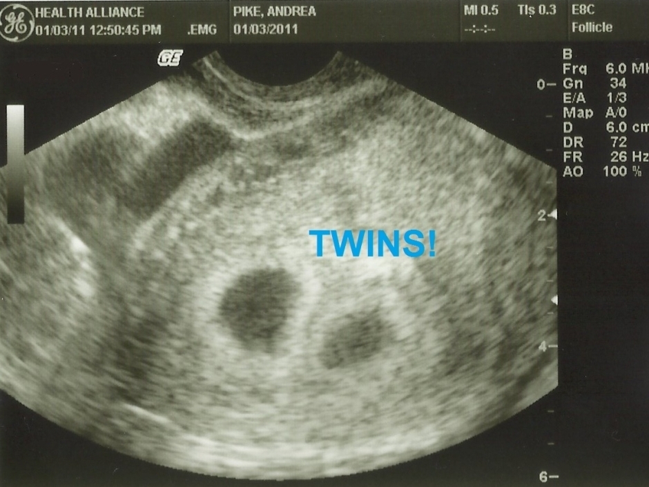 'We're Pregnant!' An Emotional Discovery After A Long Journey : The ...