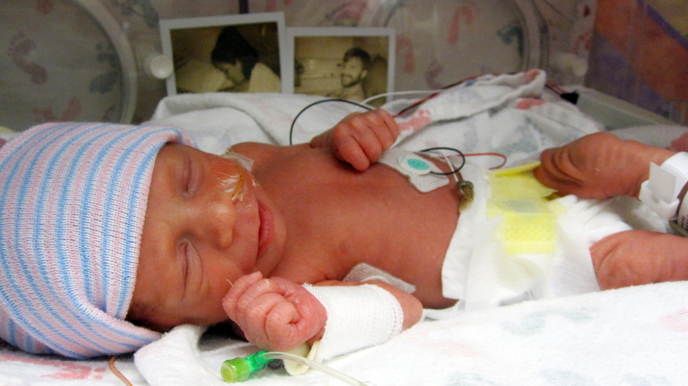 A Frightening Delivery, And A Healthy Baby Girl : The Baby Project : NPR