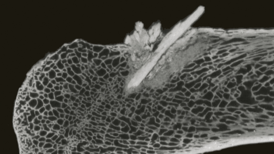 What Slew An Ancient Mastodon? DNA Tells Tale : NPR