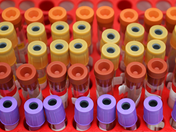 Retail Labs Give Patients Information But Needle Doctors NCPR News
