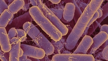 Thriving Gut Bacteria Linked To Good Health : Shots - Health News : NPR