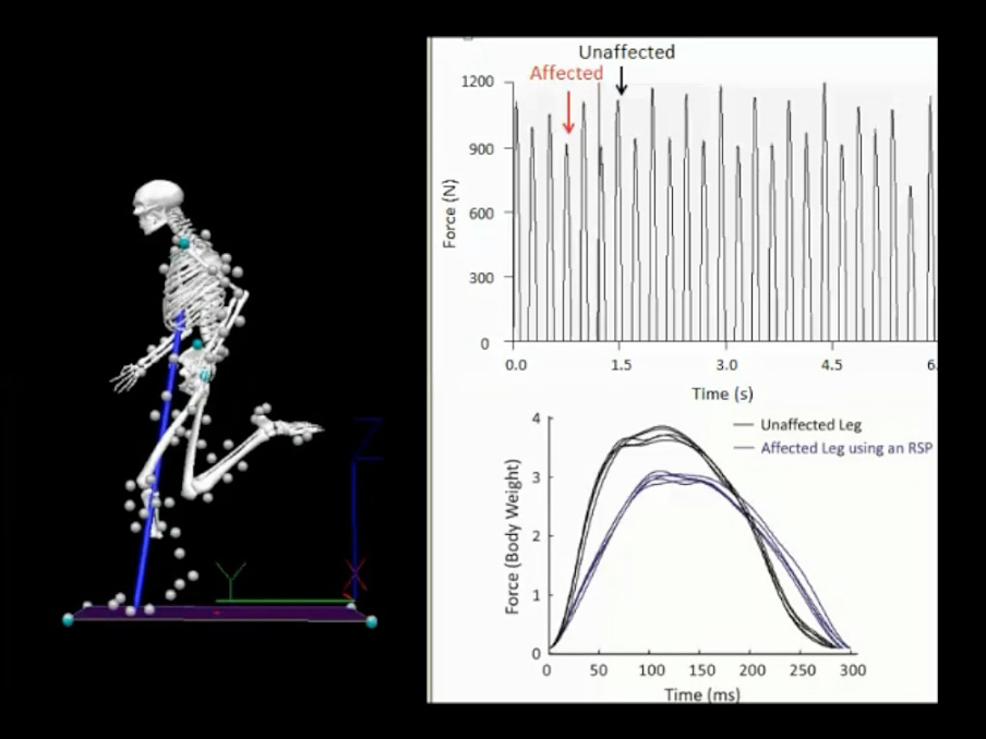 Studying Oscar Pistorius: Does The 'Blade Runner' Have An Advantage ...