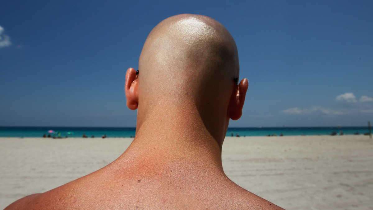 How Sunlight Weakens Your Skin : Shots - Health News : NPR