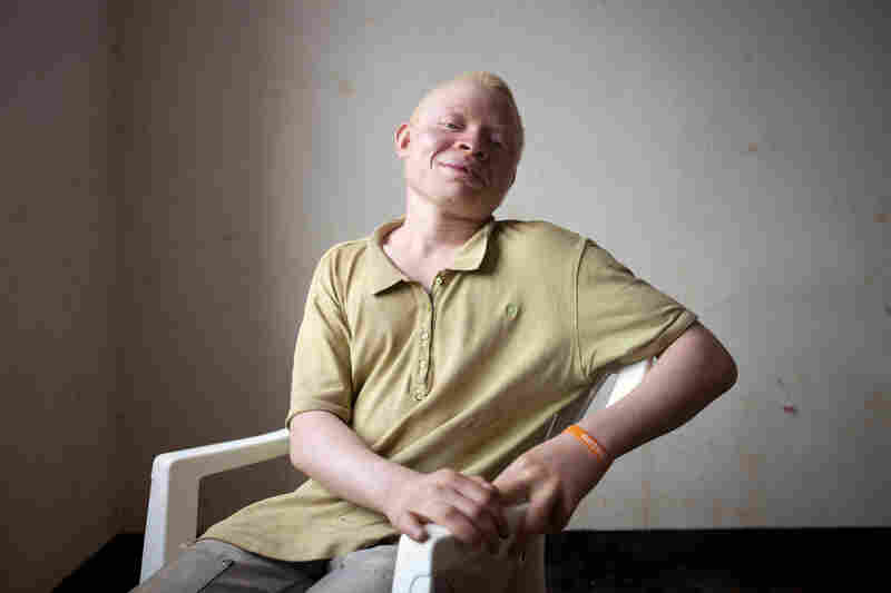 Portraits of Albinism: Letting An Inner Light Shine : The Picture Show ...