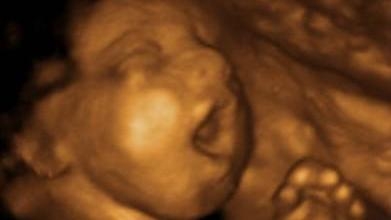 When Fetuses Yawn In The Womb : Shots - Health News : NPR