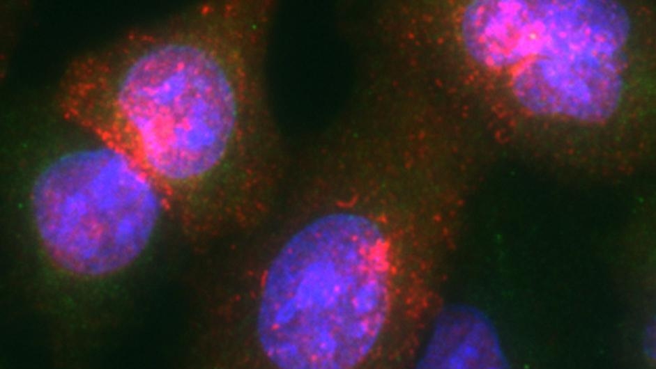 Scientists Try To Thwart Flu Virus By Resetting Its Clock : Shots ...