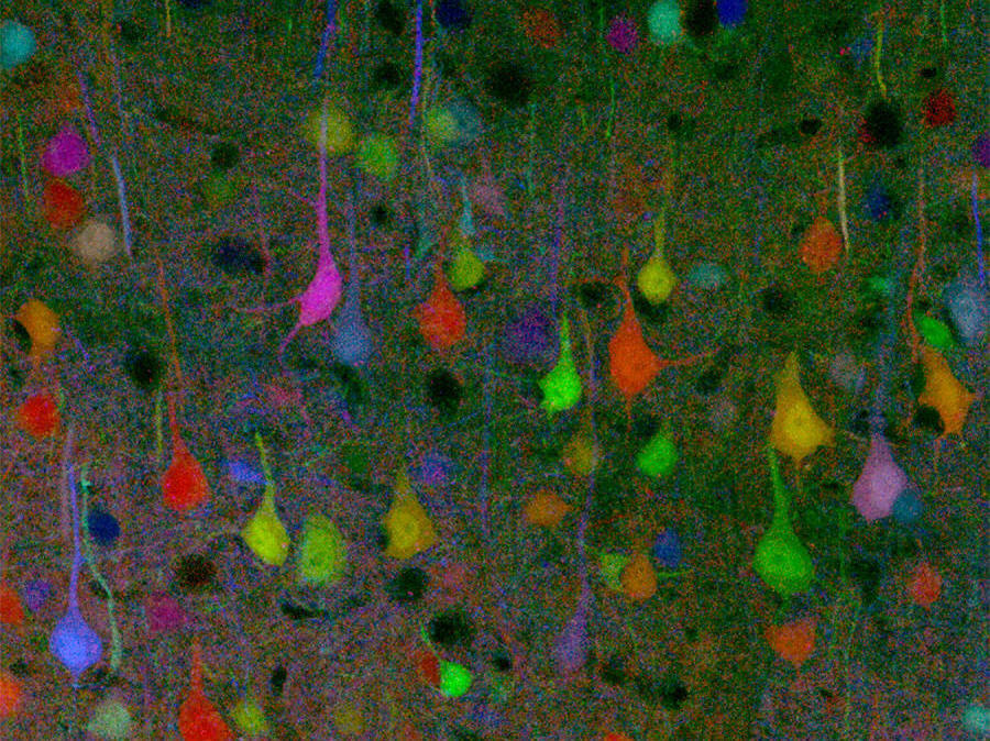 Somewhere Over The Brainbow: The Journey To Map the Human Brain : NPR