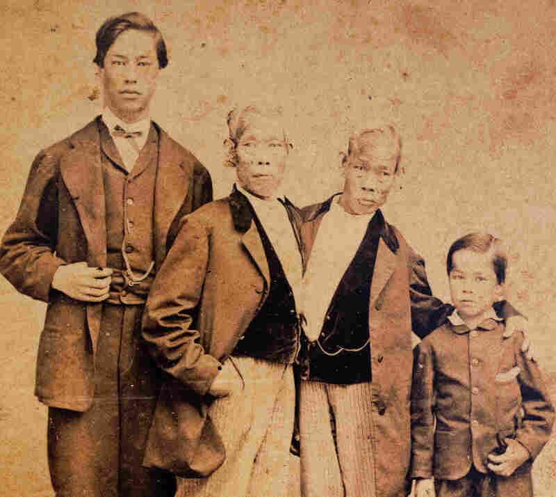 'Siamese Twins' Still Fascinate, Two Centuries Later : NPR