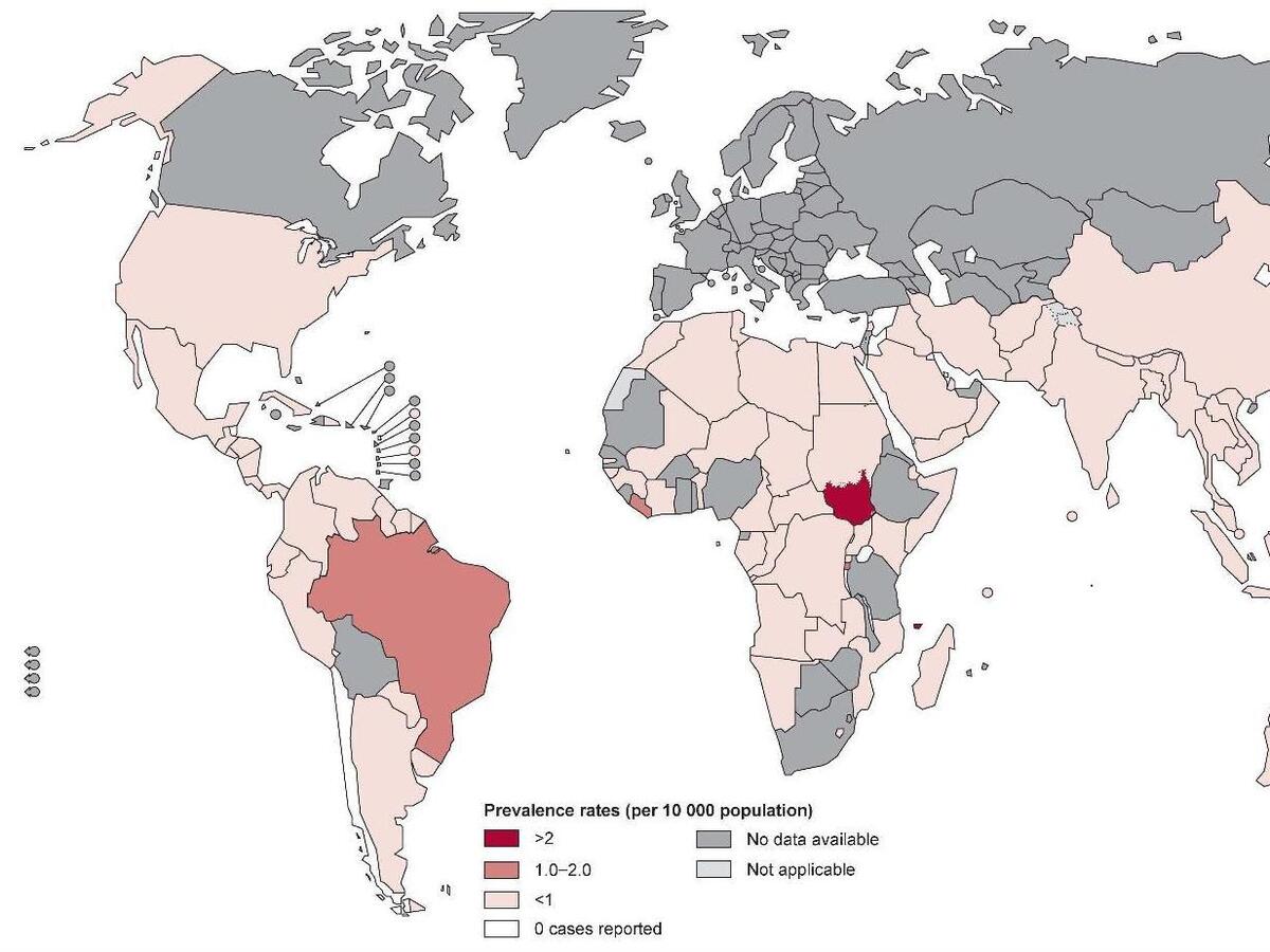 Scientists Go Medieval To Solve Ancient Leprosy Puzzle : Shots - Health ...