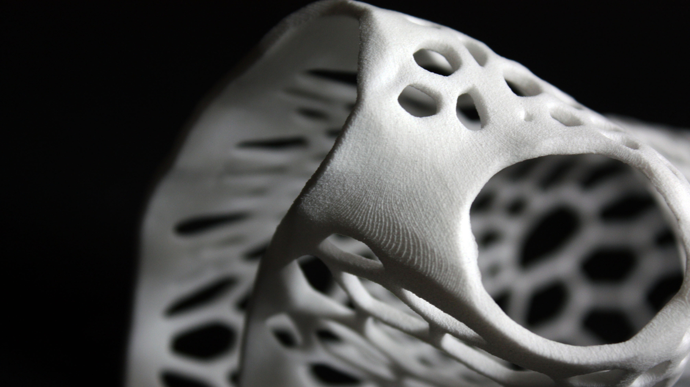 3-D Casts So Cool That You'll Almost Want To Break A Bone : Shots ...