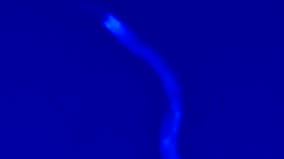 Worms' Bright Blue Death Could Shed Light On Human Aging : NPR