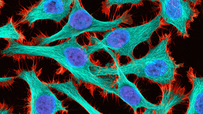 HeLa Cells: NIH And Lacks Family Agree On DNA Access : Shots - Health ...