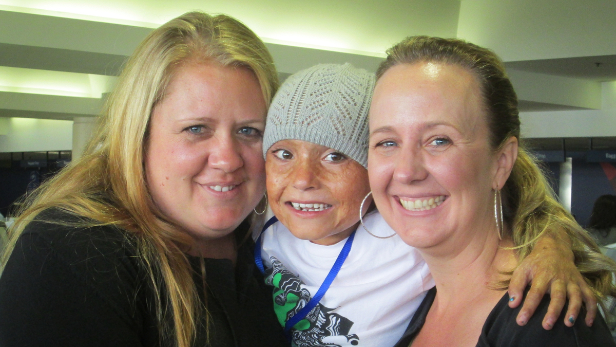 A Young Afghan War Survivor Touches Two American Lives : NPR