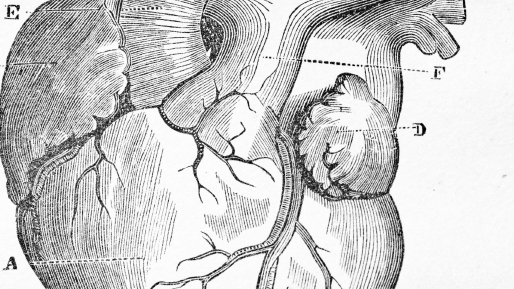 Intensive Treatment Could Prevent Many Heart Attacks : Shots - Health ...