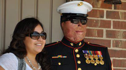 Severely Burned Marine Finds Strength In Nascent Marriage : NPR