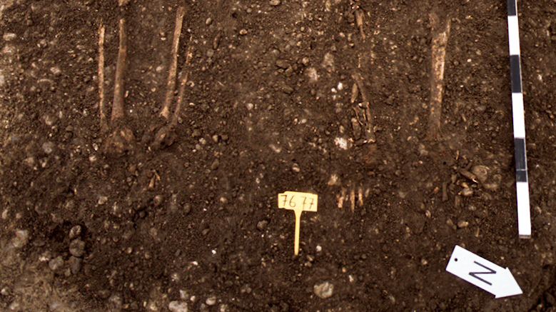 Ancient Plague's DNA Revived From A 1,500-Year-Old Tooth : Shots ...