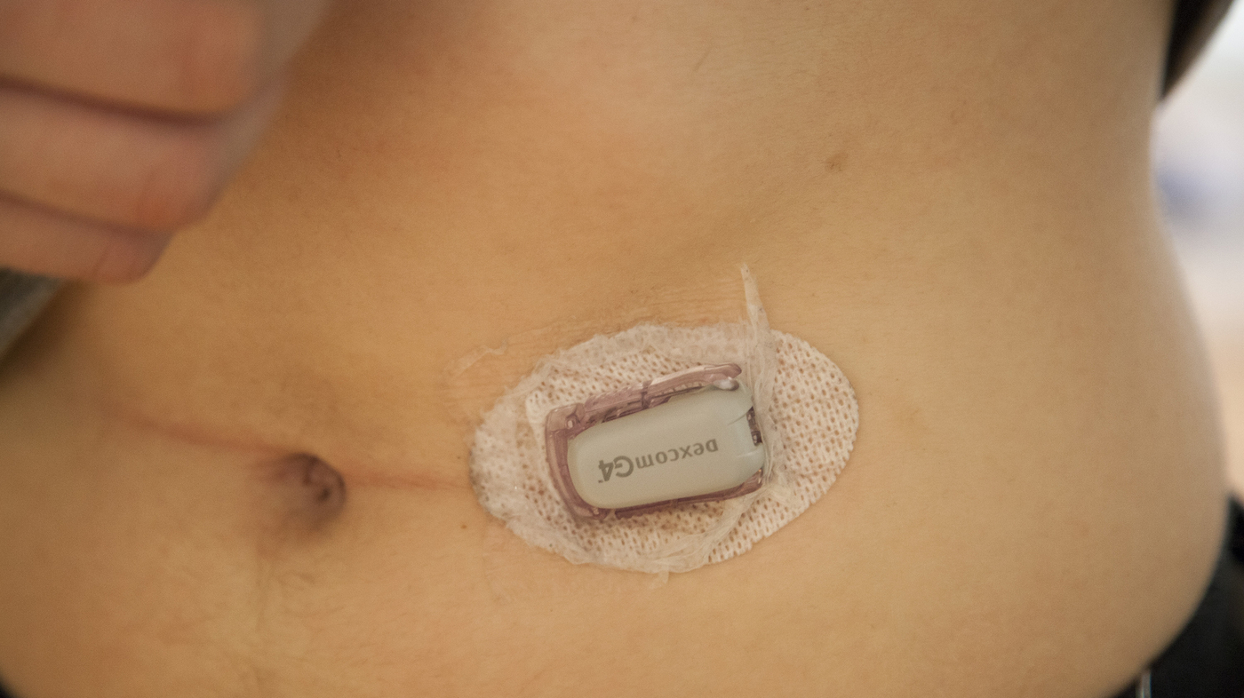 Father Devises A 'Bionic Pancreas' To Help Son With Diabetes : Shots ...