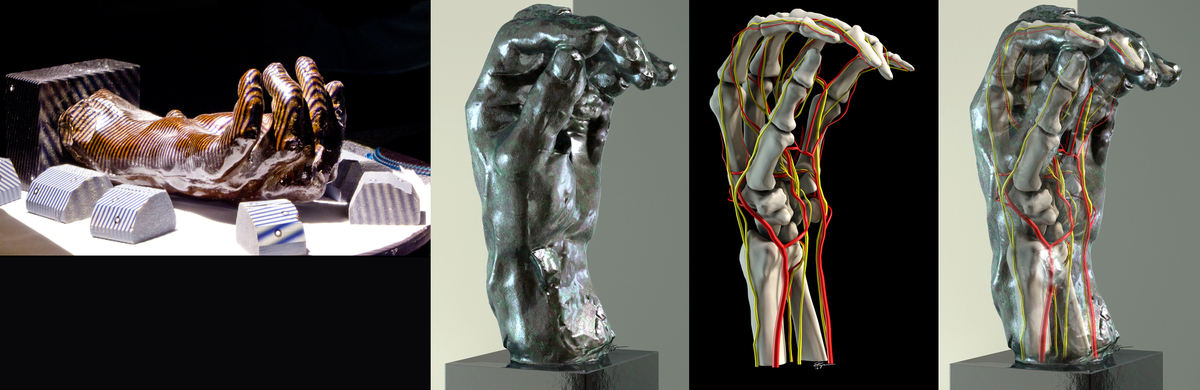 Using A 3-D Version Of Rodin's Hands To Understand Anatomy : All Tech ...