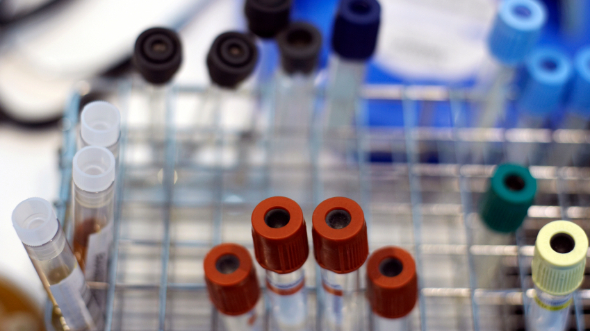 Wide Range Of Hospital Charges For Blood Tests Called 'Irrational ...