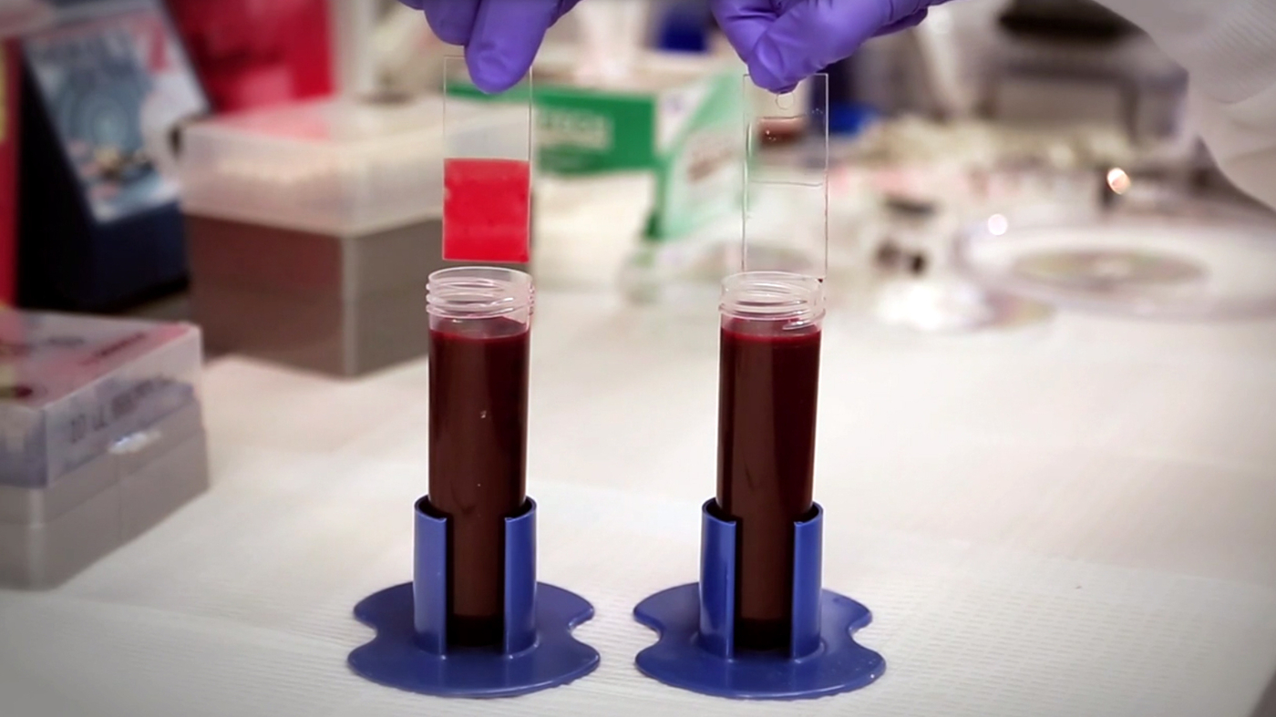 Slippery When Coated: Helping Medical Devices Prevent Blood Clots ...