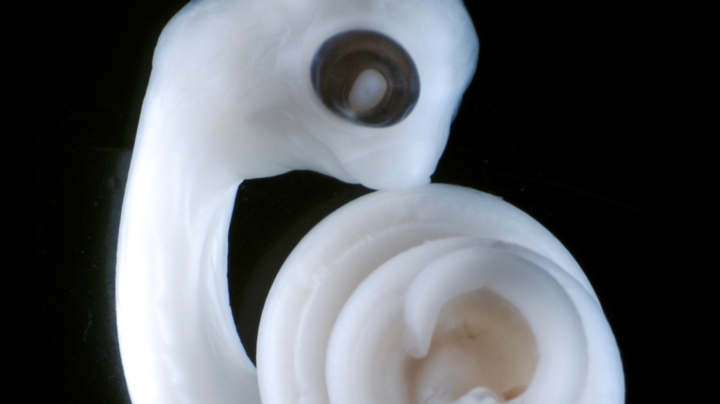 How Boy Bits First Came To Be : Shots - Health News : NPR