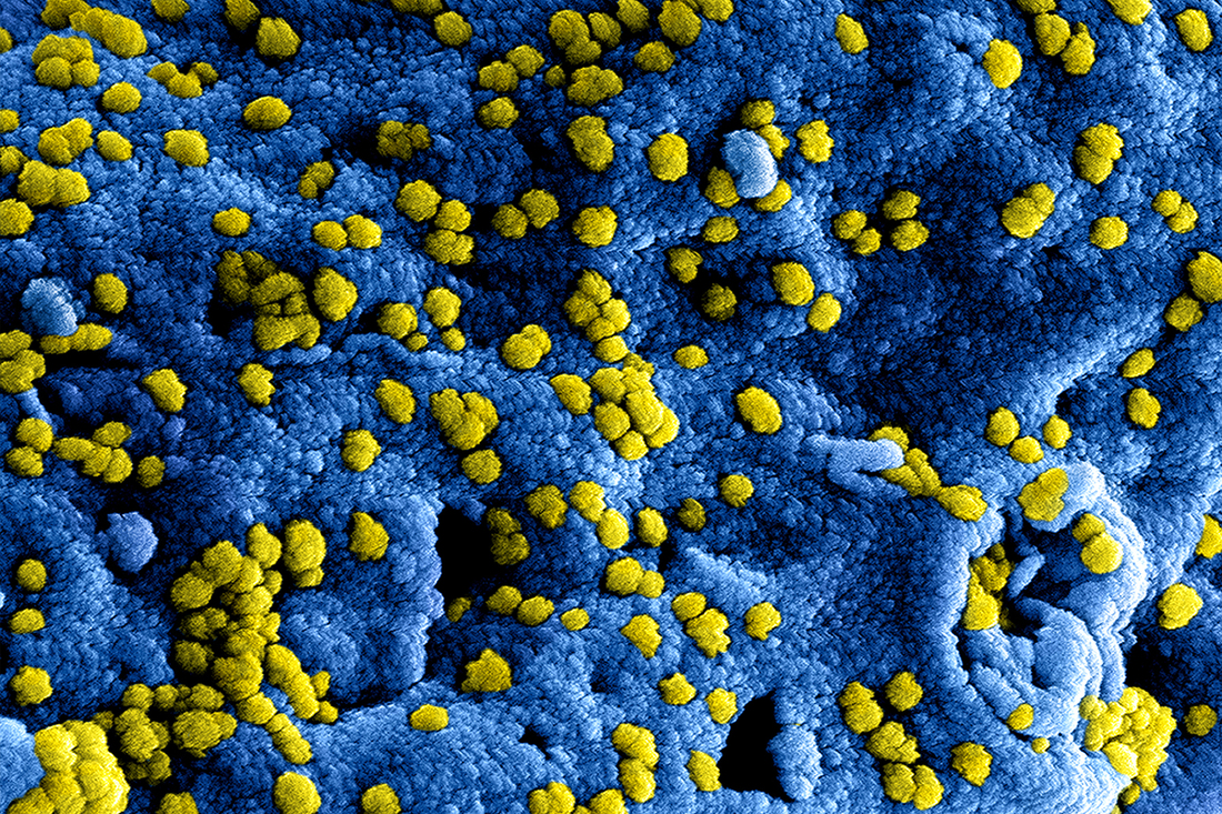 How A Tilt Toward Safety Stopped A Scientist's Virus Research : Shots ...