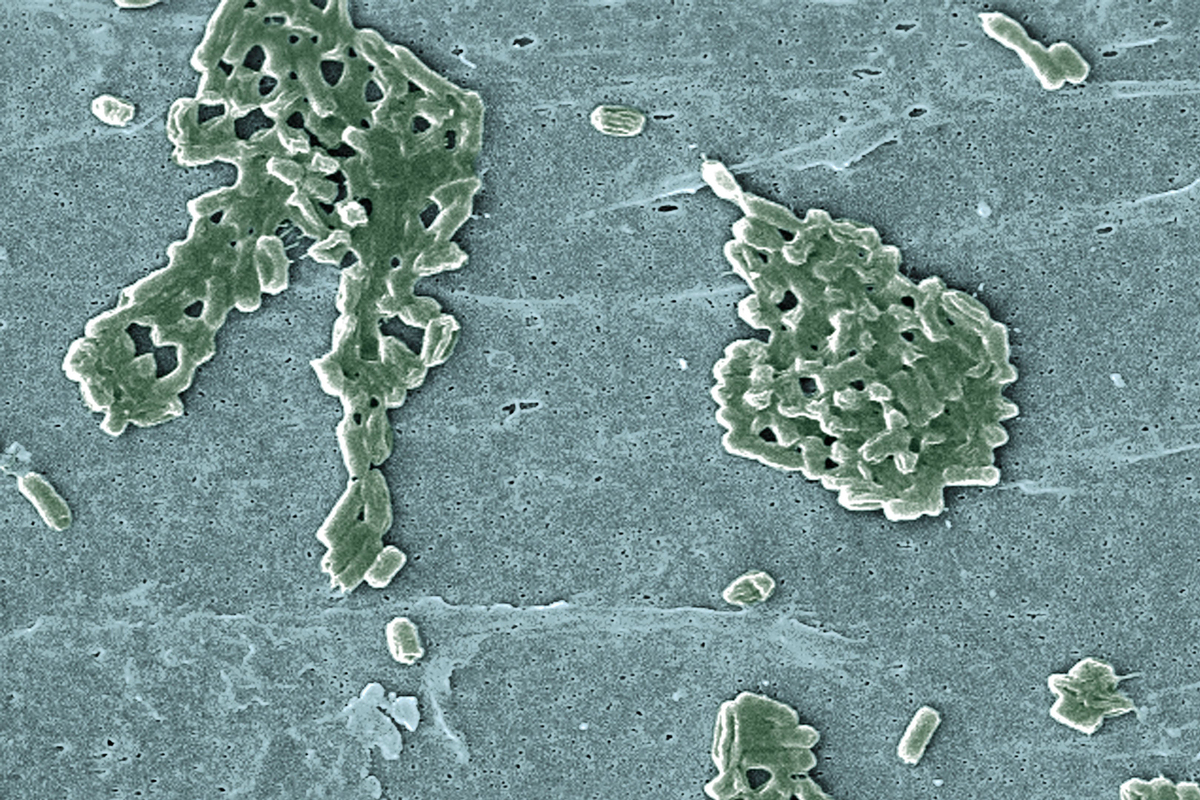 Scientists Give Genetically Modified Organisms A Safety Switch : Shots ...