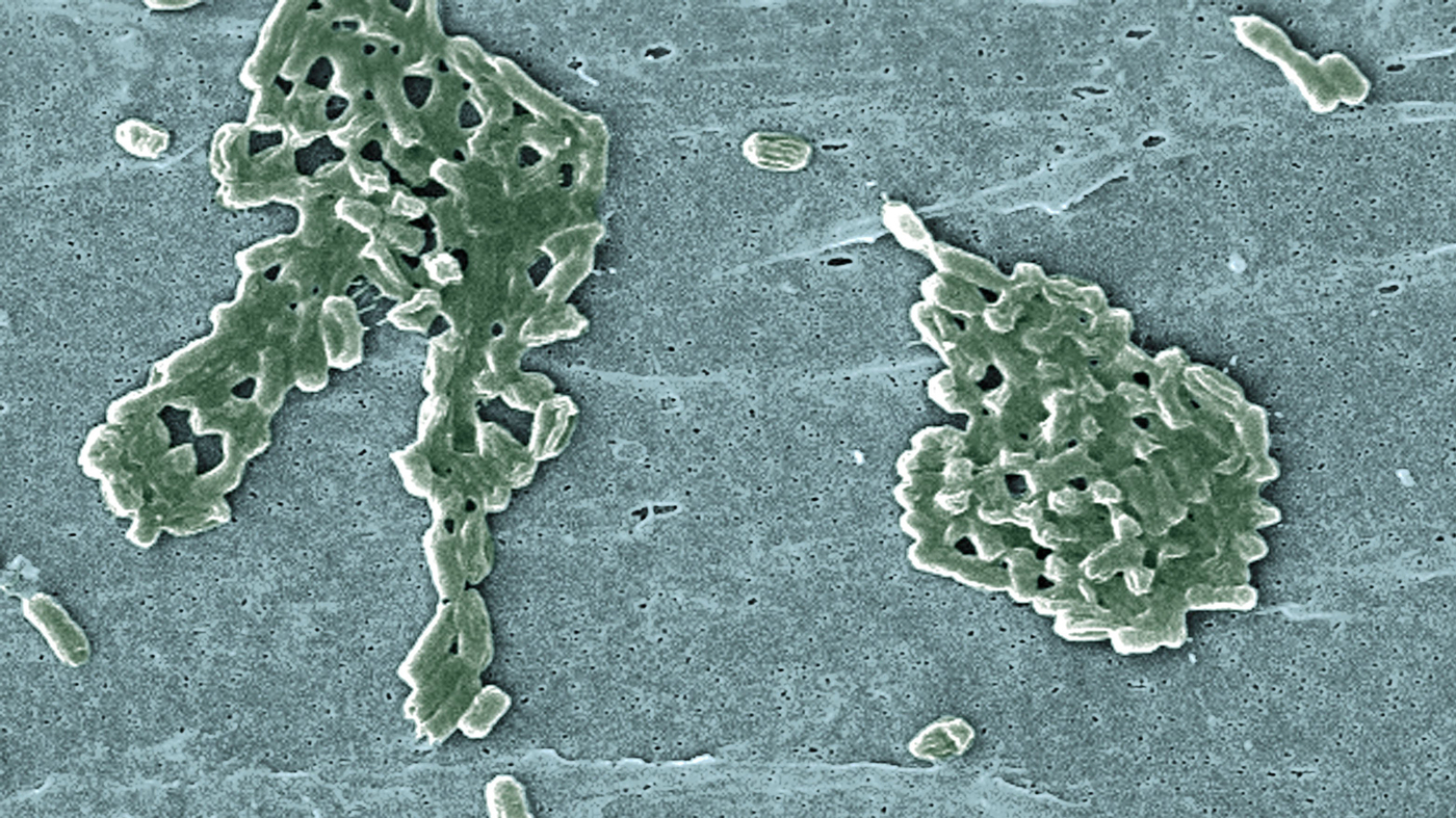 Scientists Give Genetically Modified Organisms A Safety Switch : Shots ...