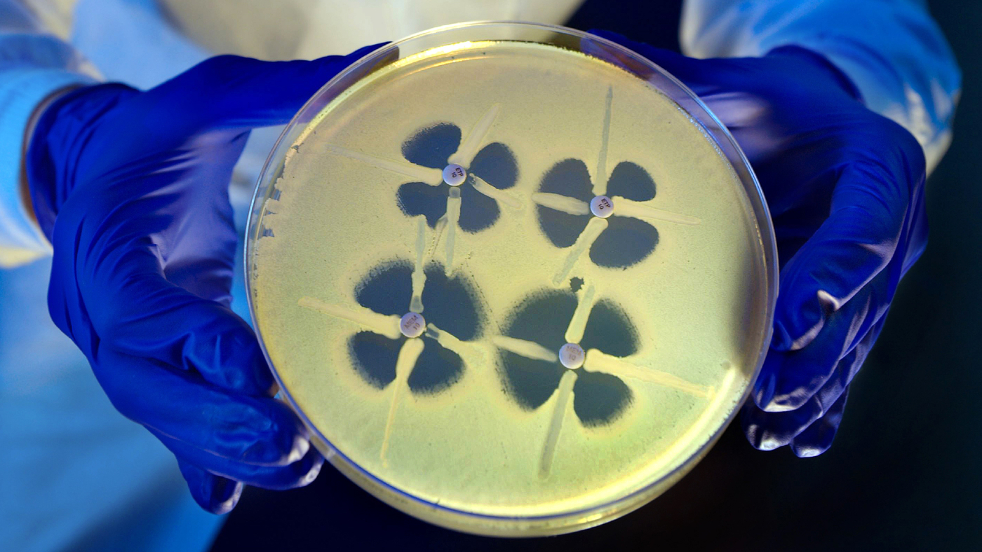 Why California's Superbug Outbreak Isn't As Scary As It Seems : Shots ...