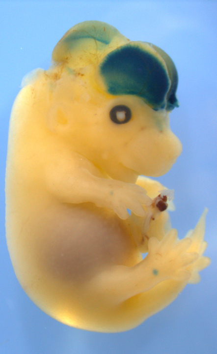 Just A Bit Of DNA Helps Explain Humans' Big Brains : Shots - Health ...