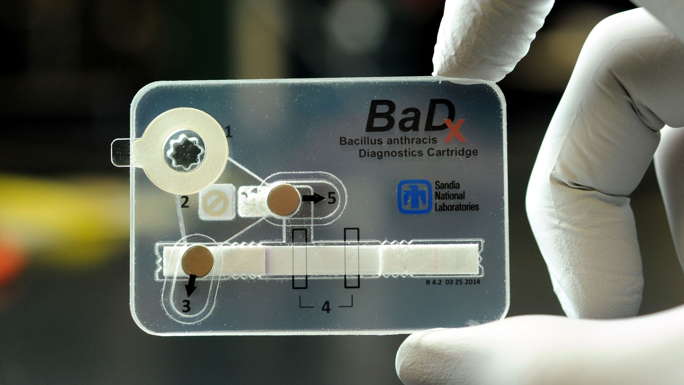 Safer Anthrax Test Aims To Keep The Bioweapon From Terrorists : Goats ...