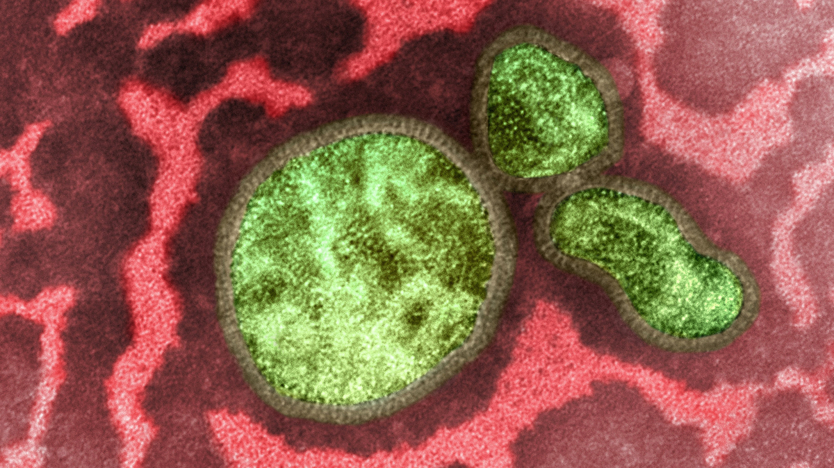 A Single Gene May Determine Why Some People Get So Sick With The Flu ...