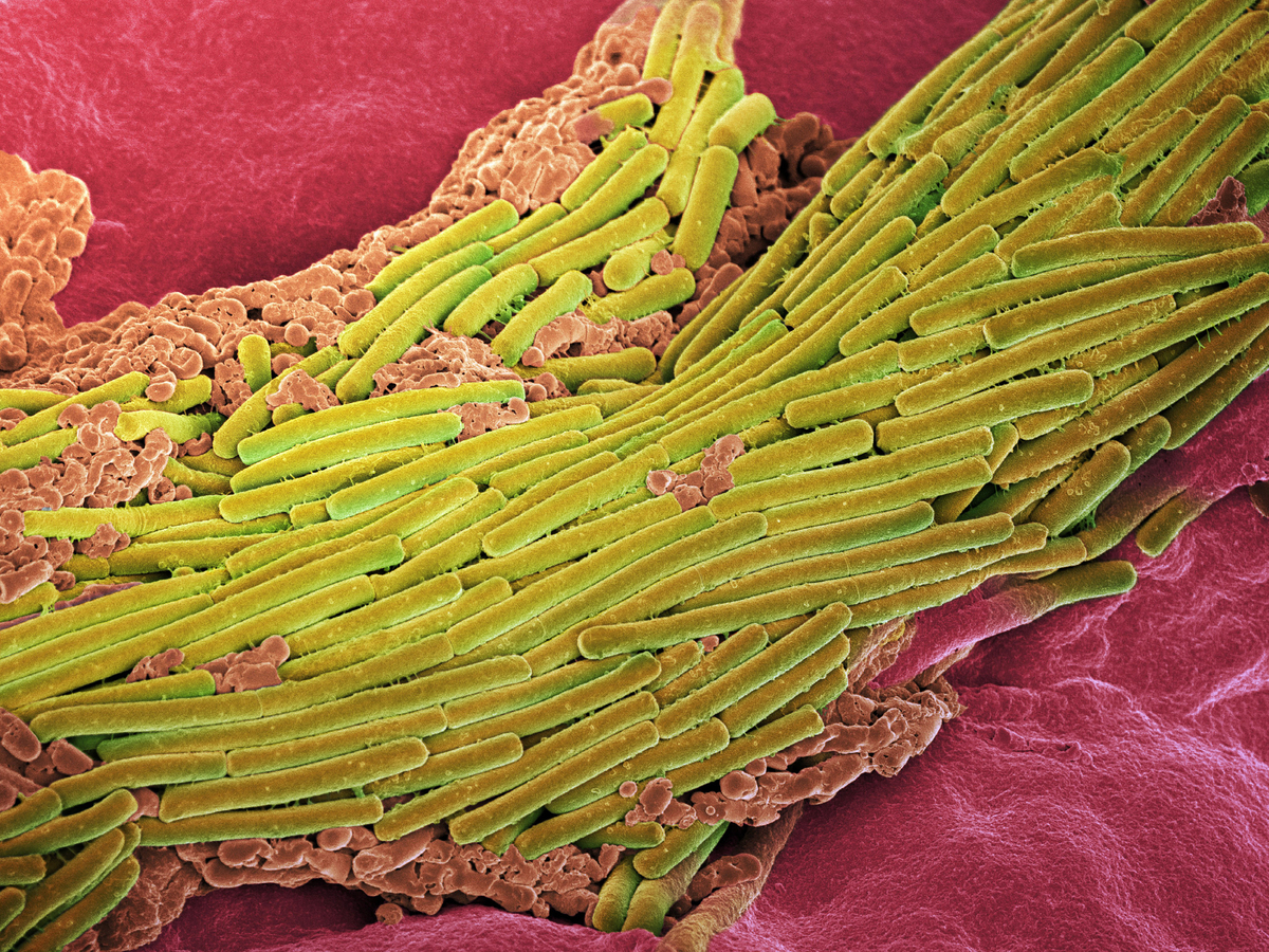 Spore Wars Help Fend Off Life-Threatening Bacterial Infections : Shots ...