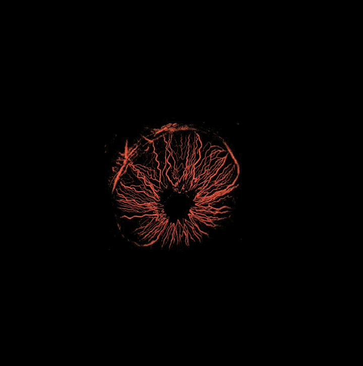 Innovative Brain Imaging Combines Sound And Light : Shots - Health News ...