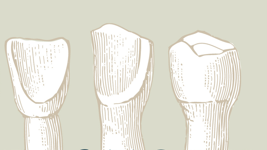 'Story Of My Teeth' Covers Art, Identity And Dental Adventures : NPR