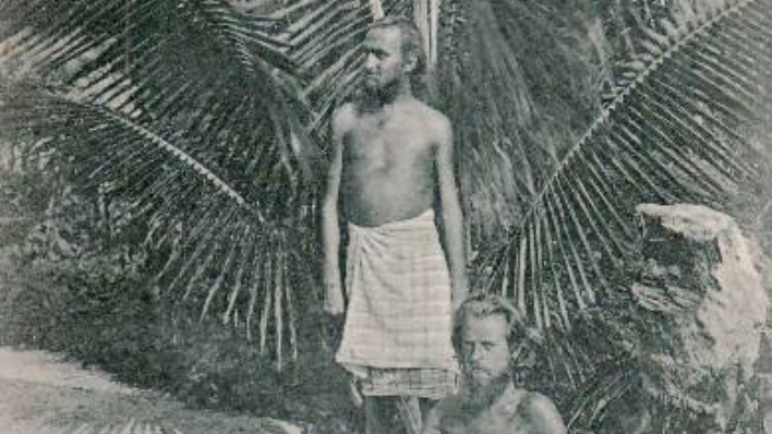 Death By Coconut: A Story Of Food Obsession Gone Too Far : The Salt : NPR