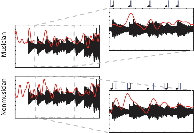 The Neuroscience Of Musical Perception, Bass Guitars And Drake : Shots ...